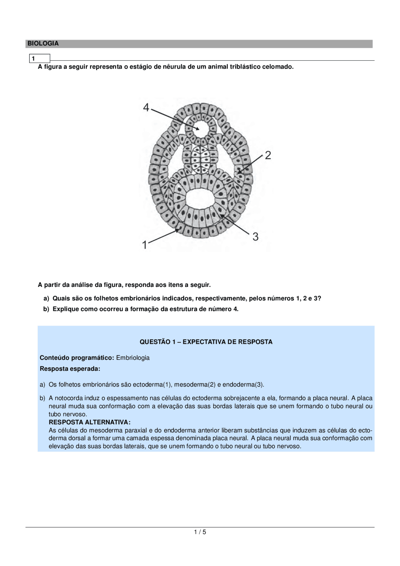 BIOLOGIA 1 A figura a seguir representa o estágio de nêurula ...