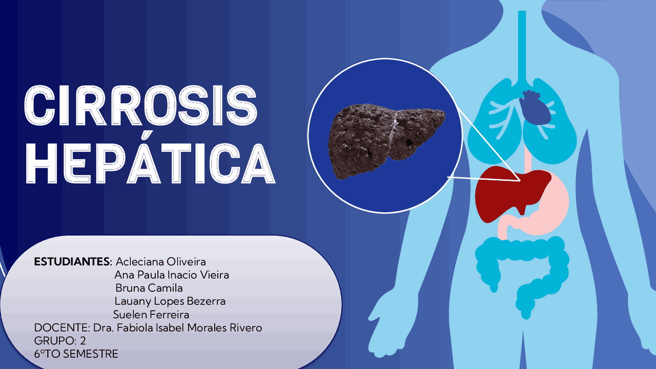 Cirrosis hepatica que es | Resúmenes de Semiología | Docsity