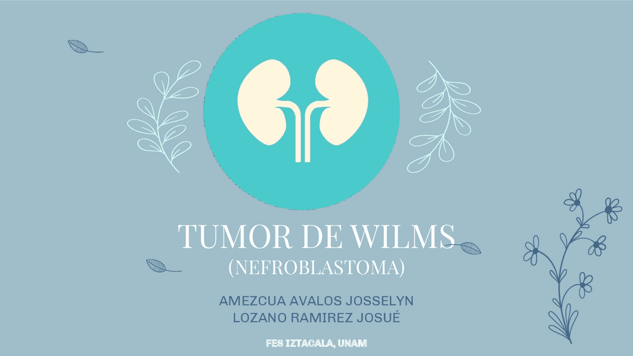Tumor de Wilms (Peditría) | Diapositivas de Pediatría | Docsity