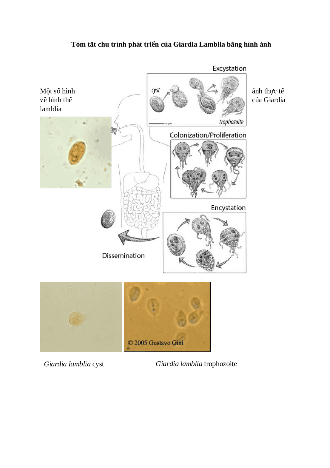 Tóm tắt chu trình phát triển của Giardia lamblia bằng hình ảnh ...
