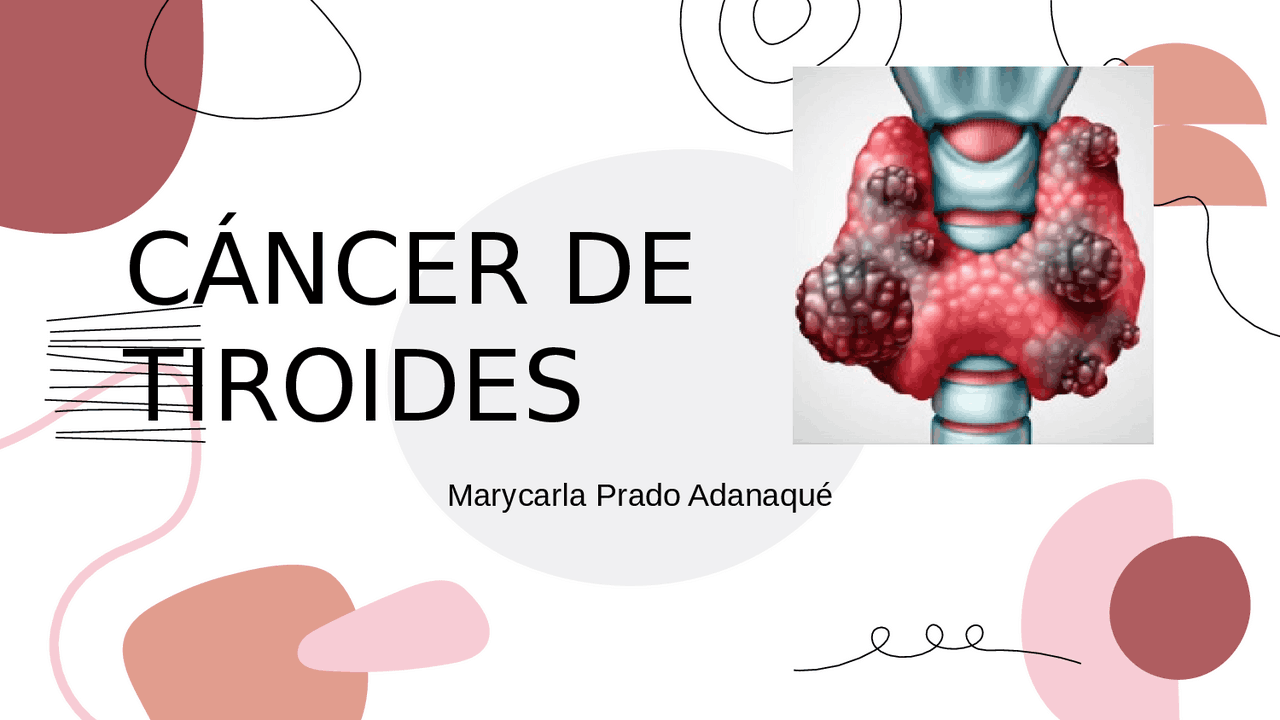 Carcinoma De Tiroides Diapositivas De Oncología Docsity