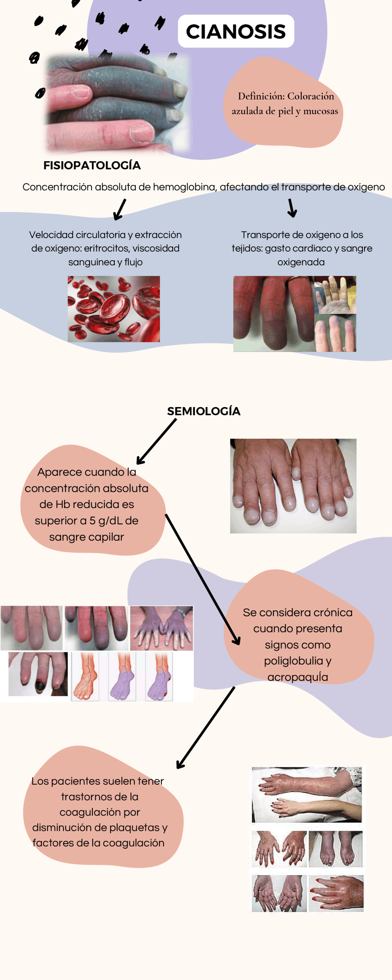 Cianosis resumen y ayuda memoria | Resúmenes de Semiología | Docsity