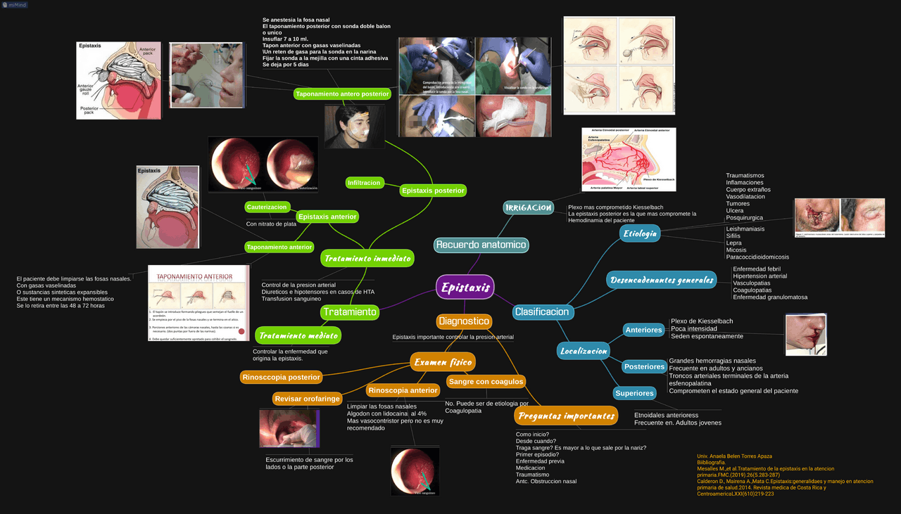 Epistaxis Aintomas Y Manejo Esquemas Y Mapas Conceptuales De