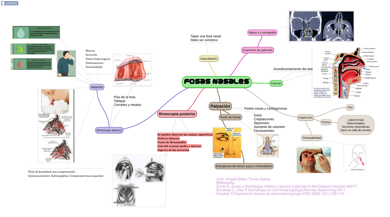 Anatomia de las fosas nasales | Esquemas y mapas conceptuales de Otorrinolaringología | Docsity