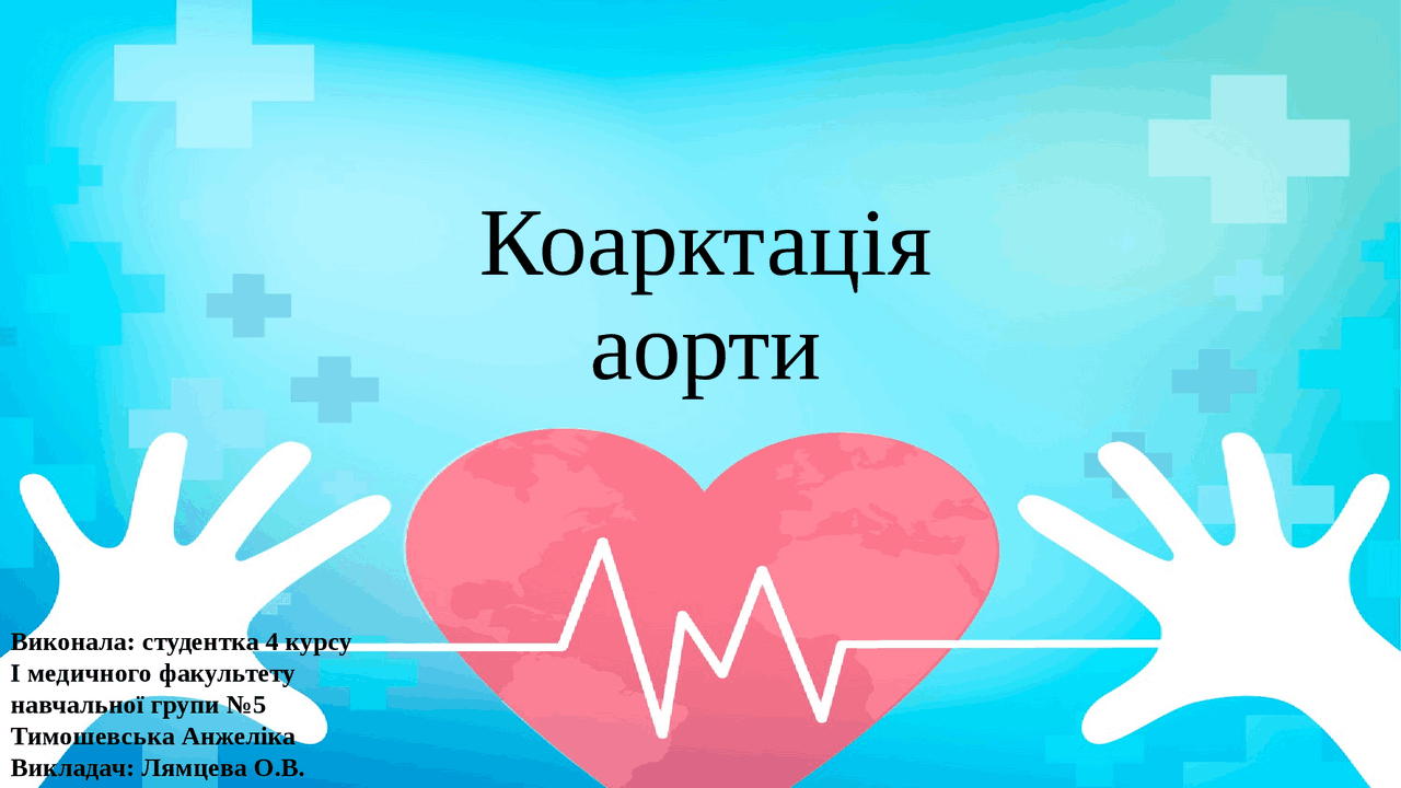 Коарктация аорти презентация Презентации Педиатрия Docsity