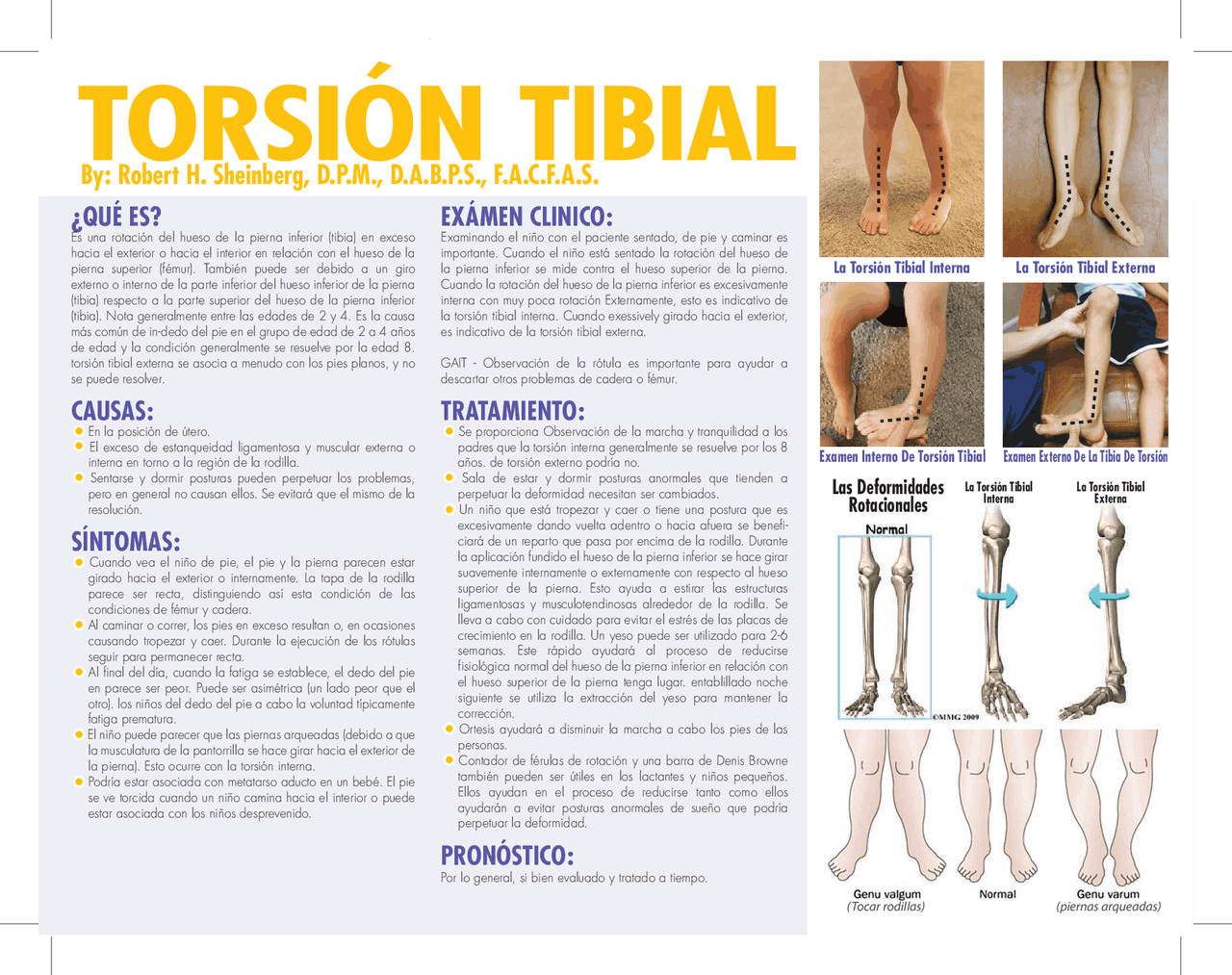 Torsión tibial anatomía de extremidad inferior | Esquemas y mapas ...