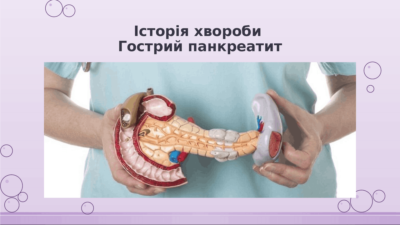 Історія хвороби гострий панкреатит Схемы Внутренние болезни Docsity