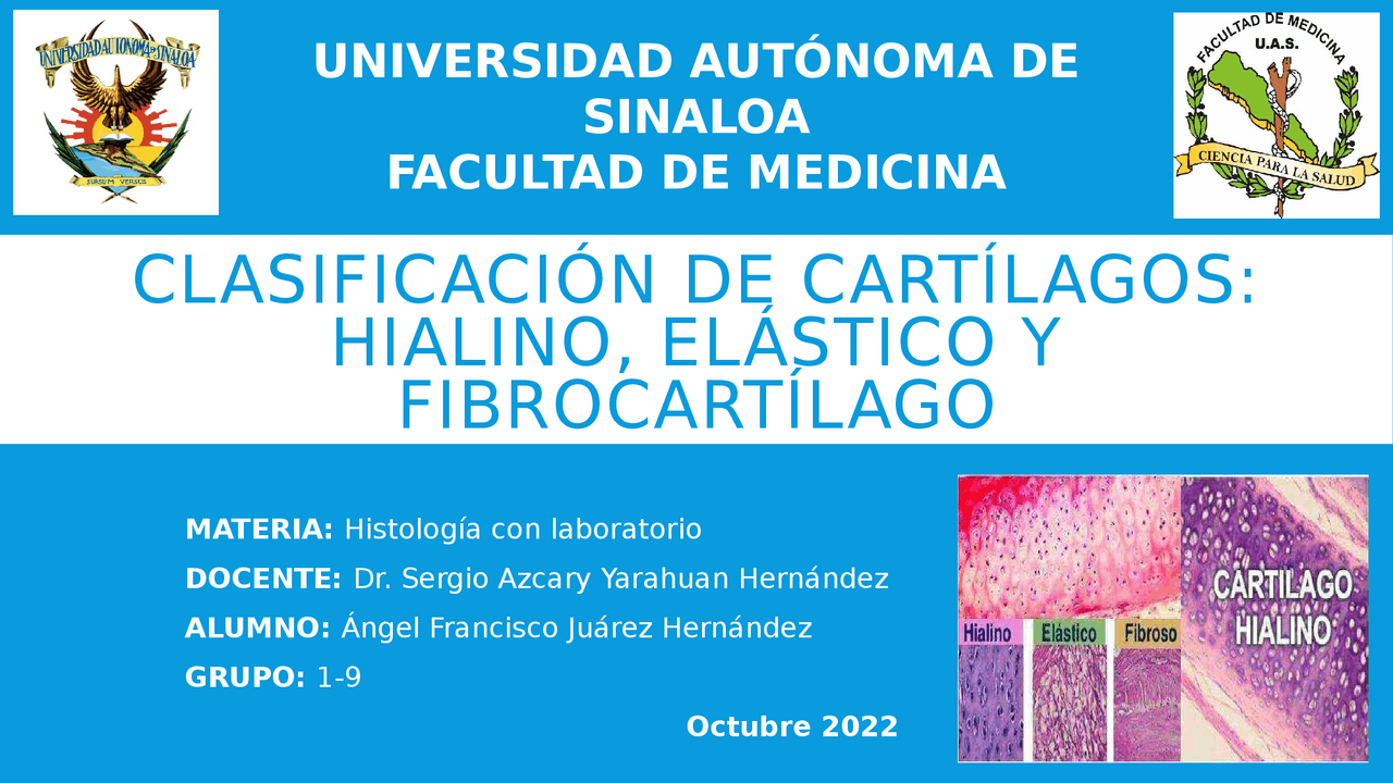 Clasificacion De Cartilagos Diapositivas De Histología Docsity
