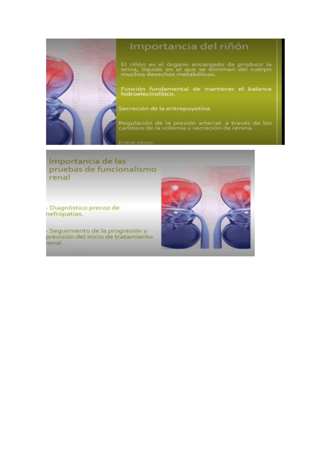 ESTADISTICAS DE RENAL | Diapositivas de Bioquímica | Docsity