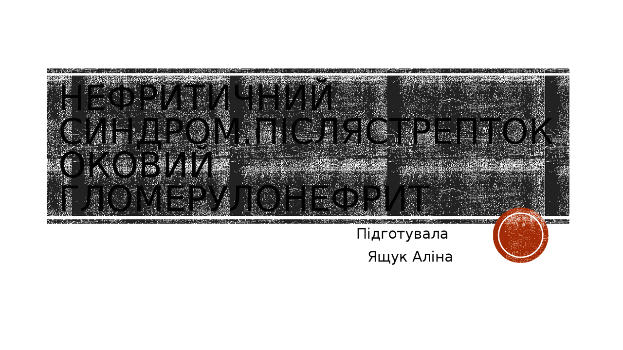 Нефротичний синдром Презентации Педиатрия Docsity