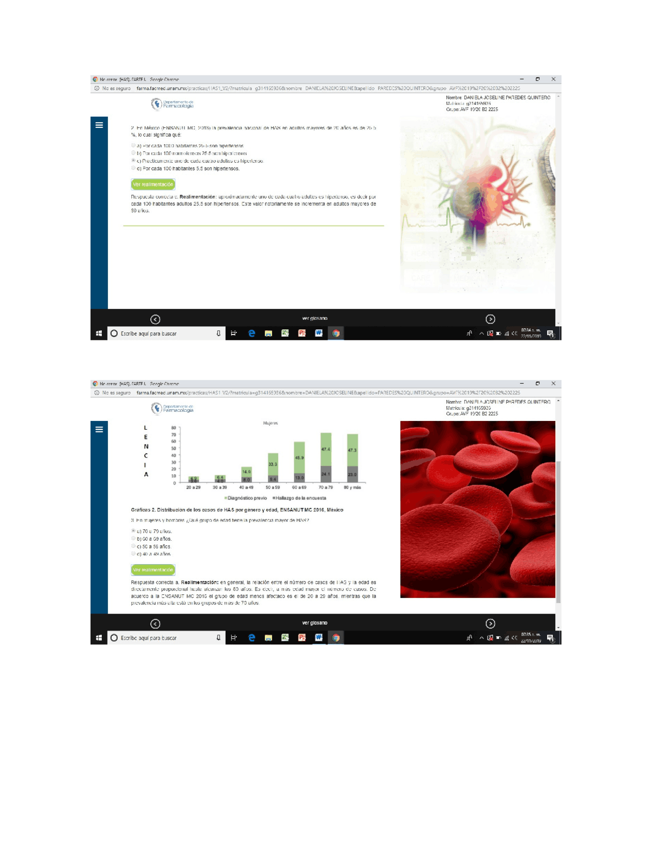 Hipertension Arterial Farmacologia Aula Virtual Monografías Ensayos