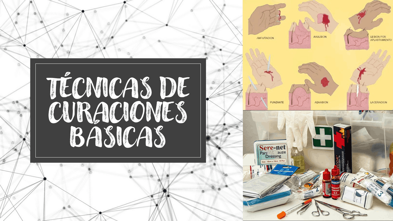 Técnicas de curaciones básicas | Diapositivas de Anatomía | Docsity