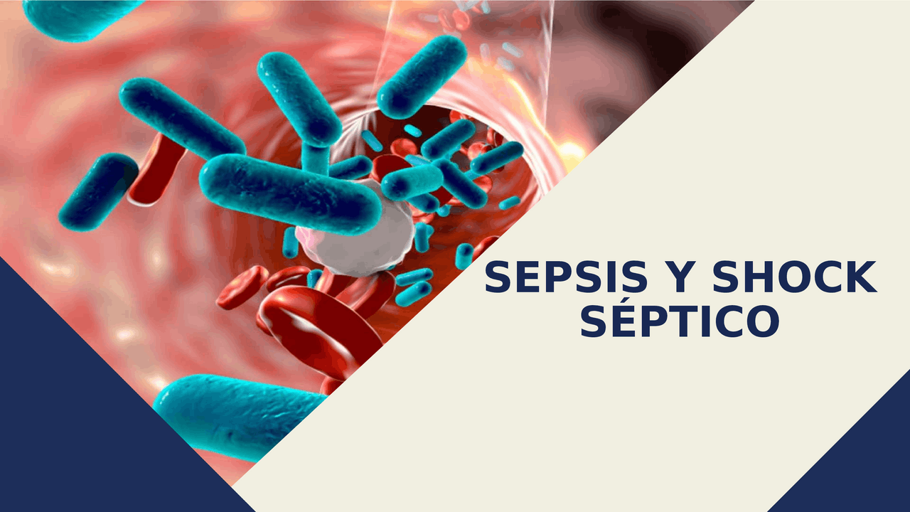 Sepsis y shock septico 1 | Diapositivas de Medicina | Docsity