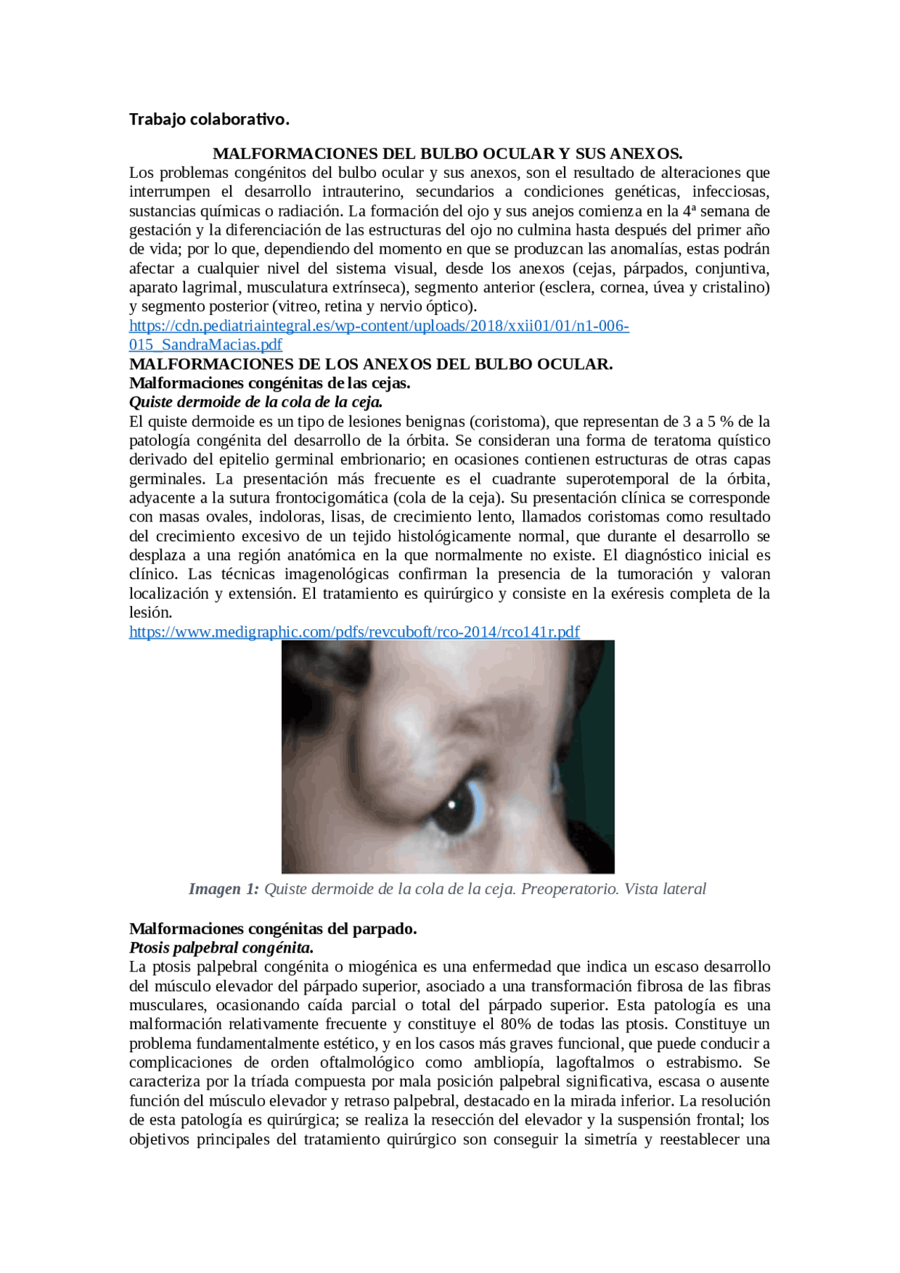 Malformaciones Del Globo Ocular Apuntes De Oftalmología Docsity