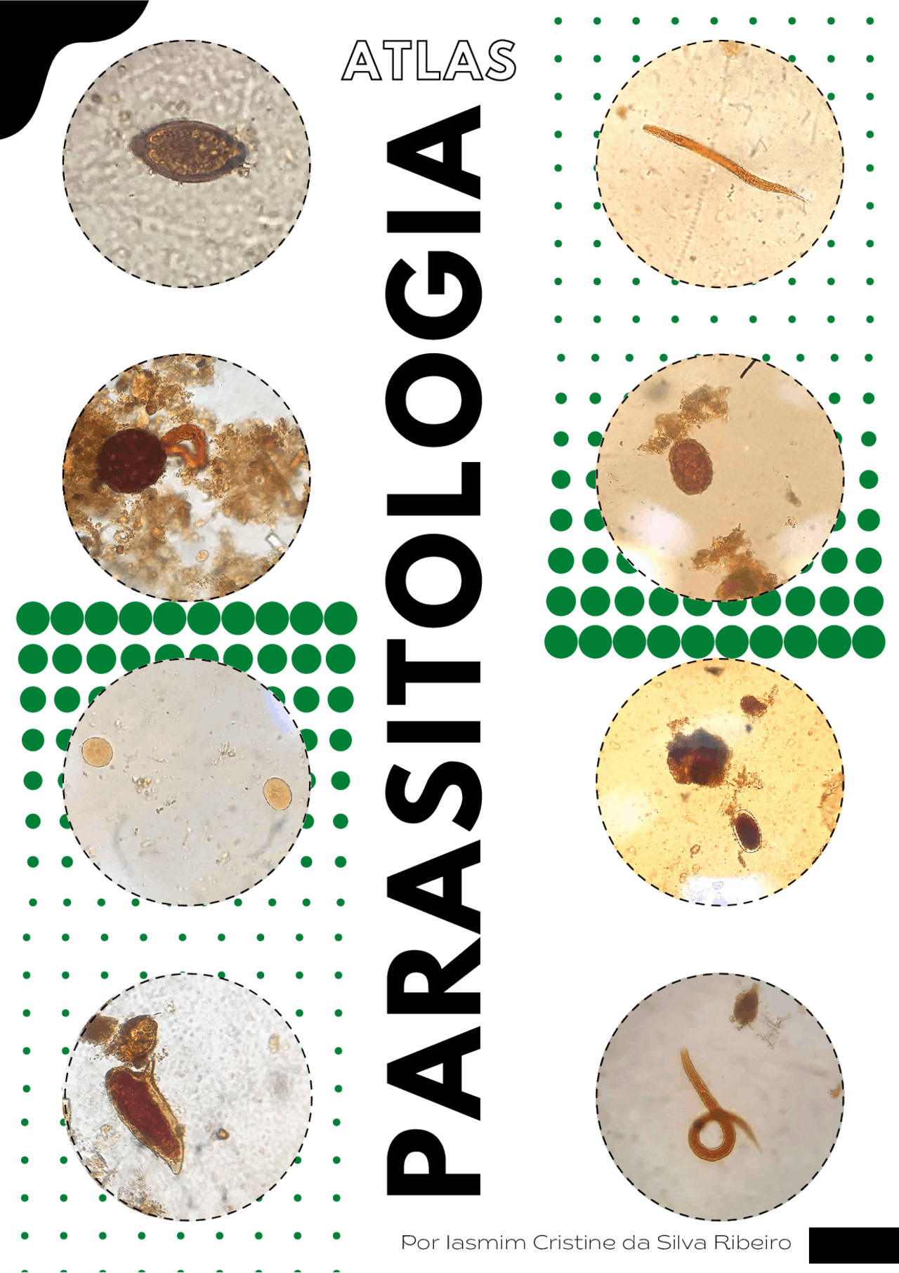 Atlas de Parasitologia | Notas de estudo Parasitologia | Docsity