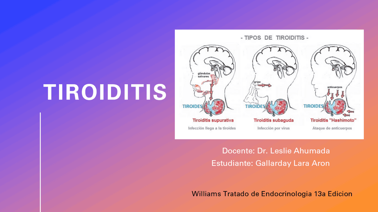 TIROIDITIS: Tiroiditis autoinmunitaria, Tiroiditis subaguda indolora ...