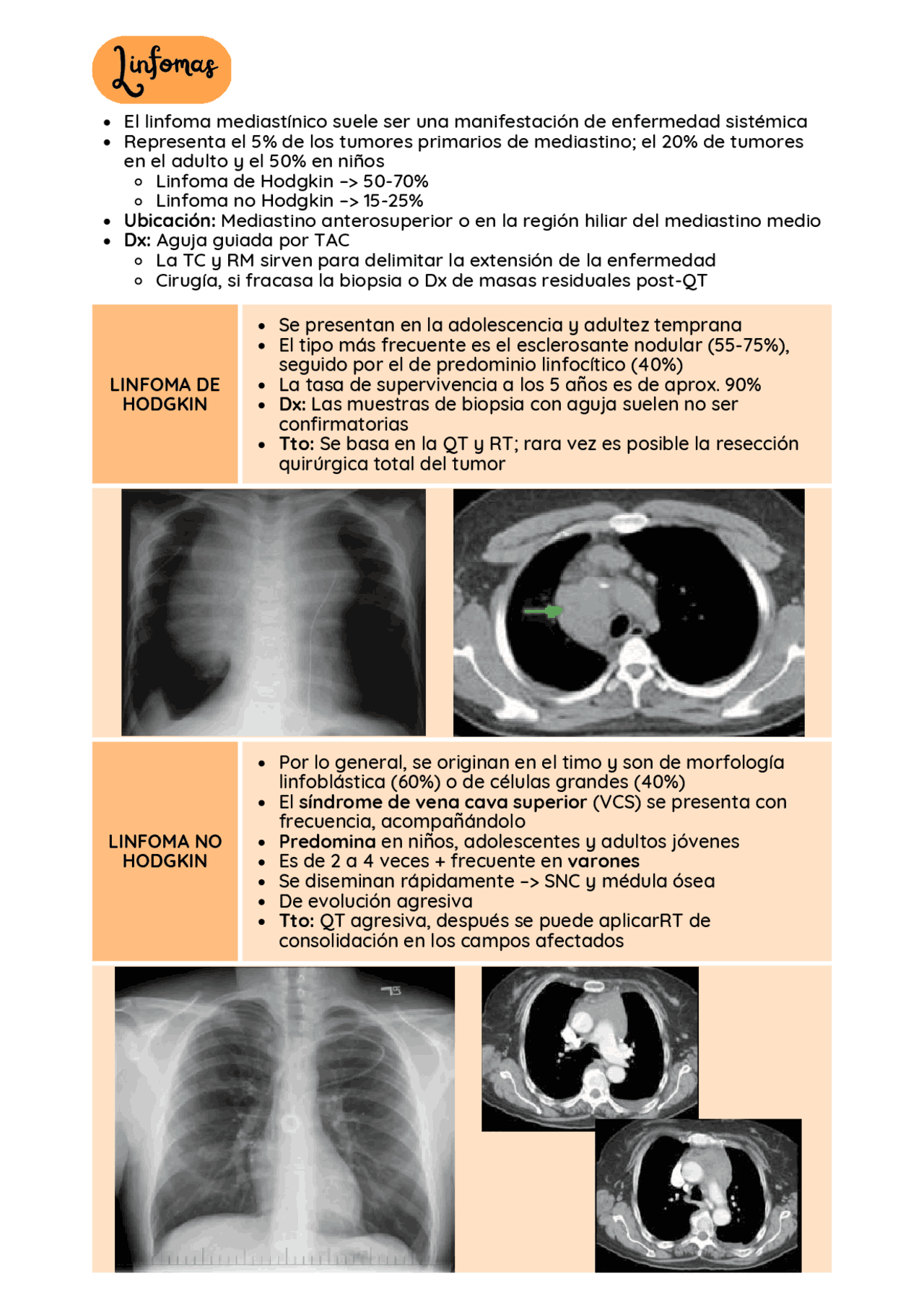 Tumores Benignos De Mediastino Resúmenes De Neumología Docsity