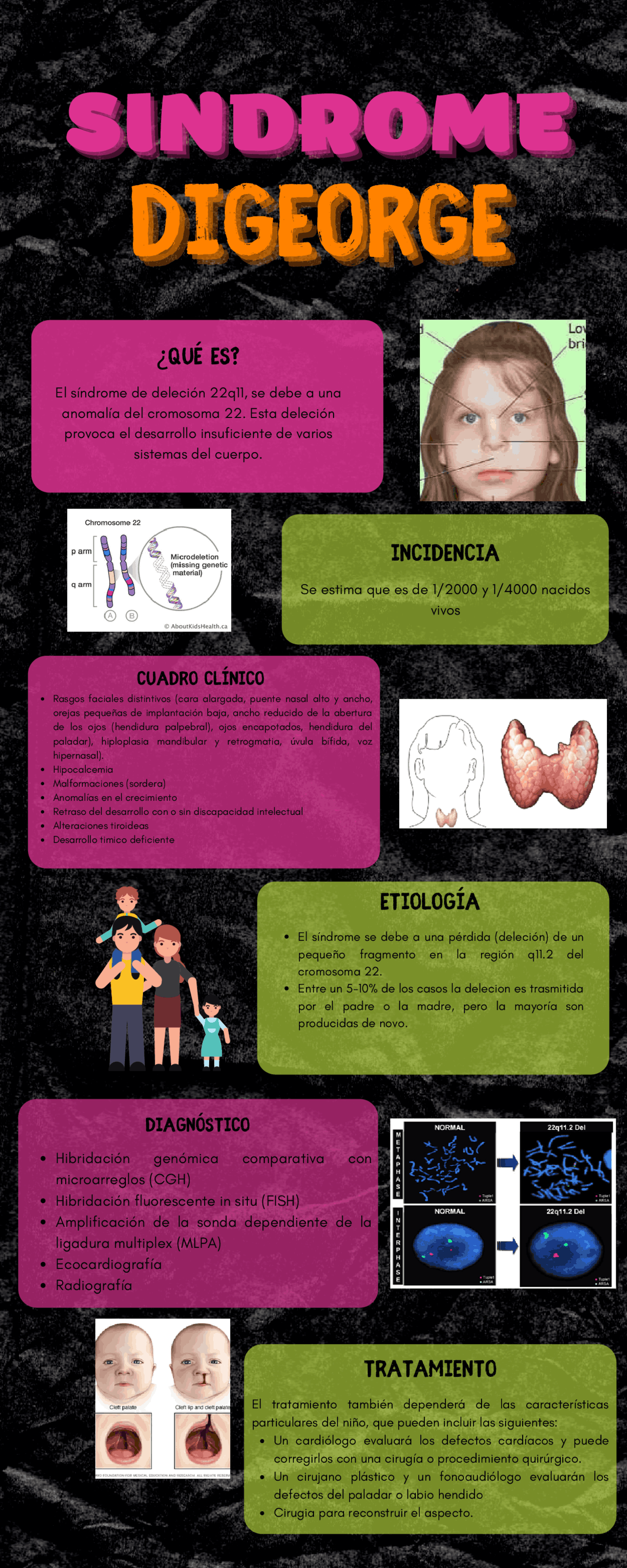 Síndrome di georGe, generalidades | Lecture notes of Embryology | Docsity