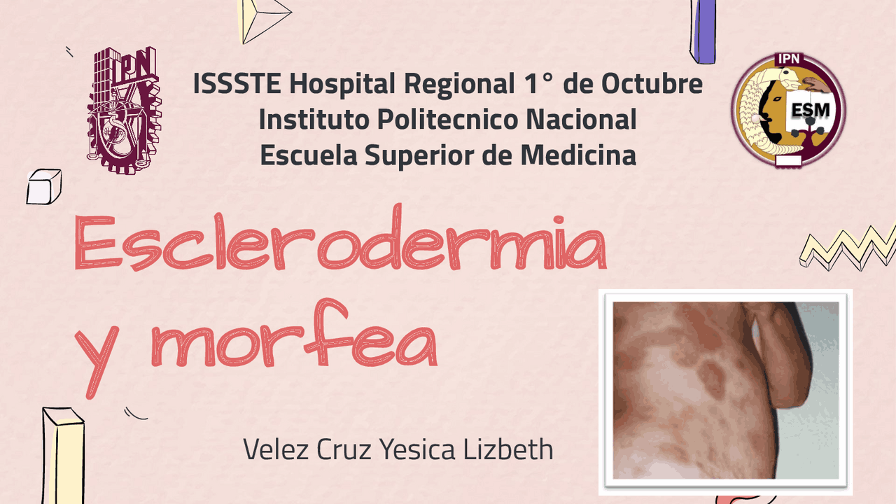 Esclerodermia y morfea. | Diapositivas de Dermatología | Docsity