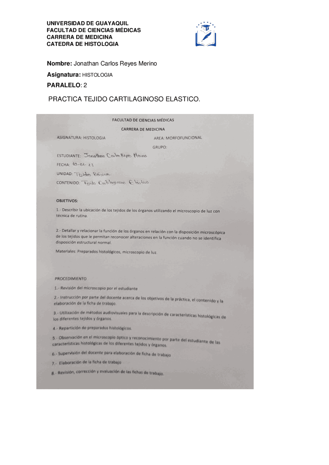 Tejido Cartilaginoso Resúmenes De Histología Docsity