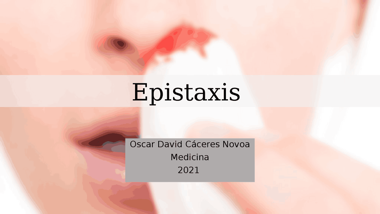 EPISTAXIS. Definición, clínica, diagnostico y manejo. | Diapositivas de ...