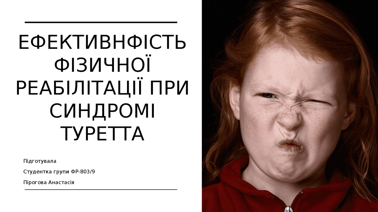 Синдром Туретта Фізична терапія ерготерапія при даному захворюванні