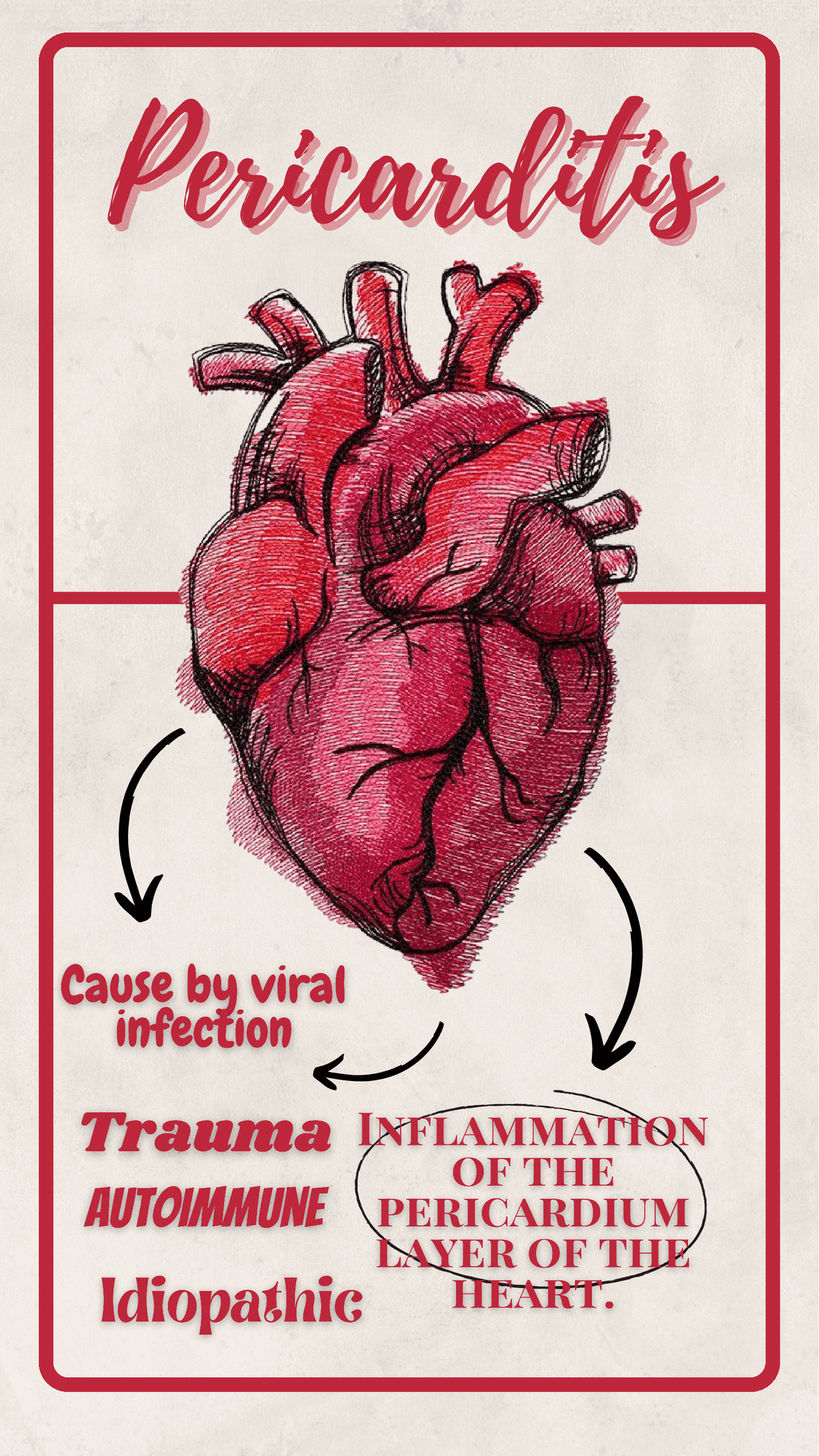 Brochure about Pericarditis | Schemes and Mind Maps Nursing | Docsity
