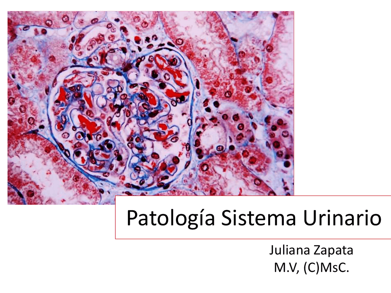 Patologías Sistema Urinario Resúmenes De Anatomía Aplicada Docsity