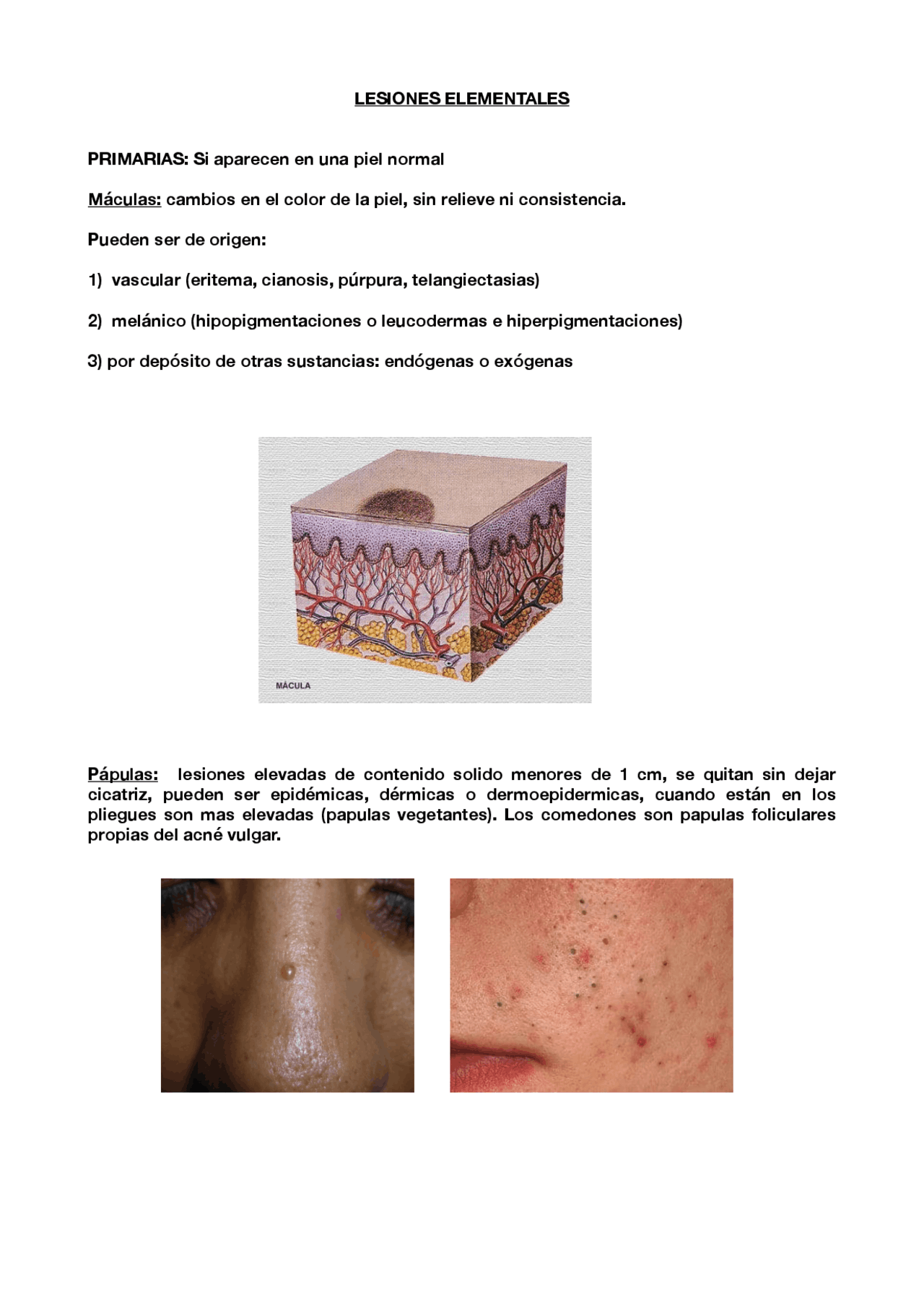 Lesiones Elementales | Apuntes de Dermatología | Docsity