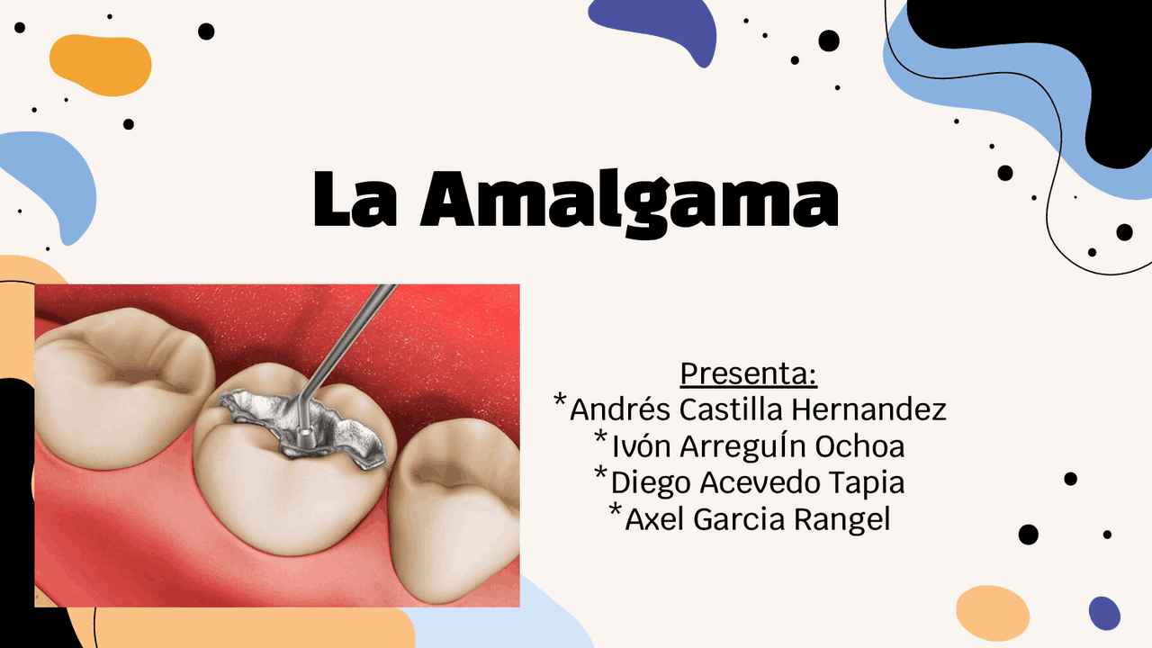 AMALGAMAS DENTALES BIOMATERIALES | Diapositivas de Biomateriales | Docsity