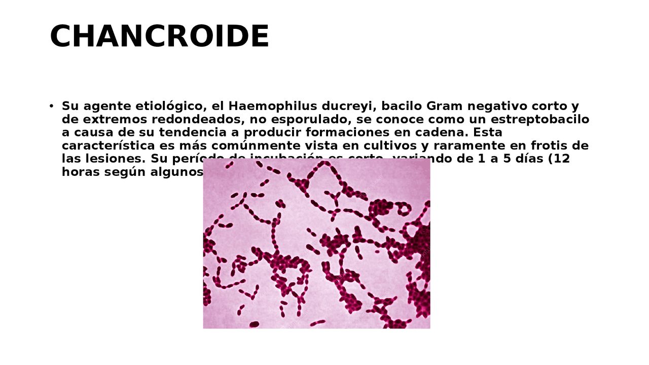 Resumen Chancroide Hernandez Perez Dermatologia | Resúmenes de ...