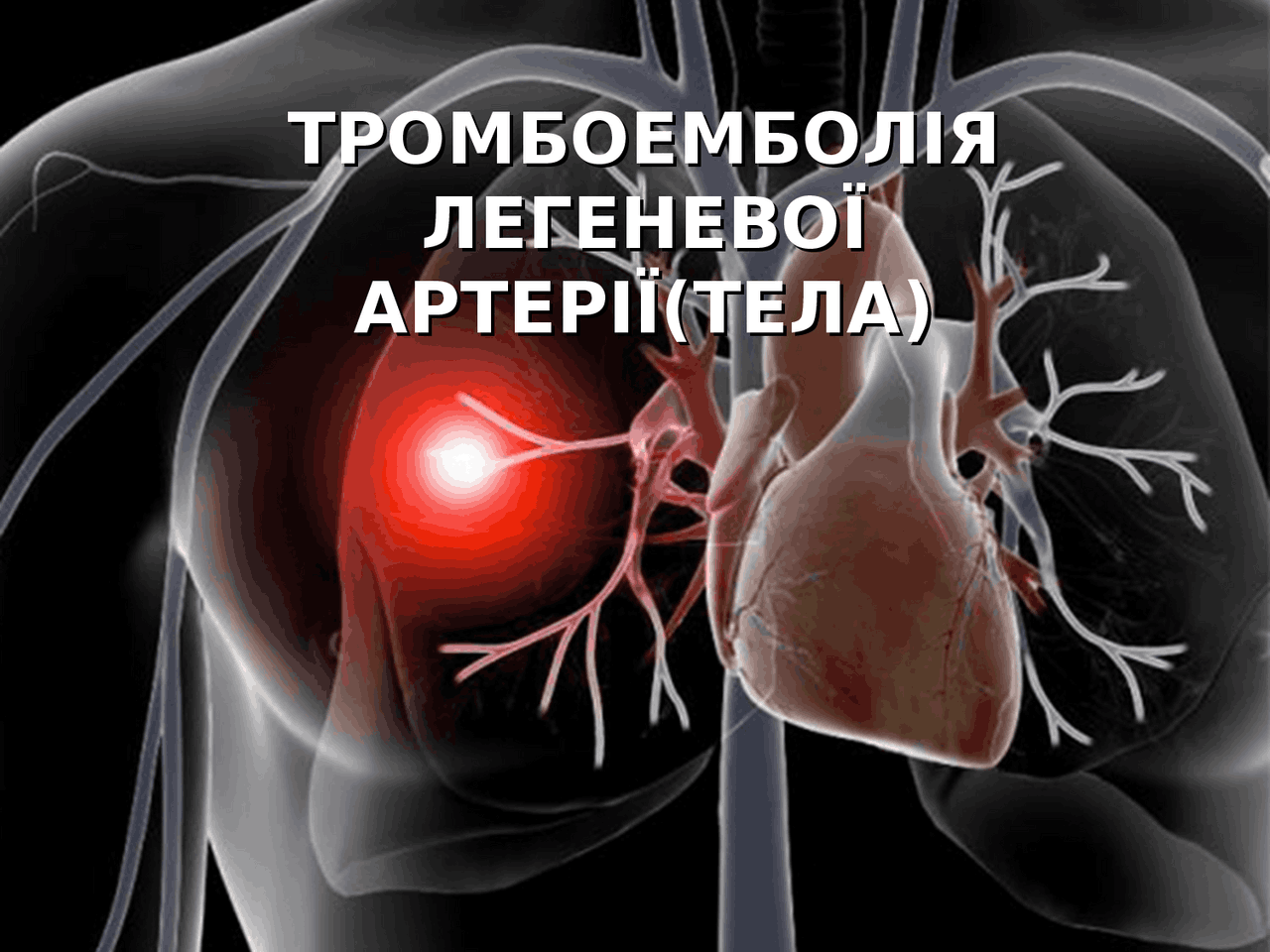 Презентація ТЕЛА хірургія Презентации Хирургия Docsity