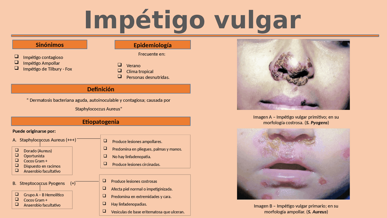 Impétigo Vulgar - Patología | Apuntes de Dermatología | Docsity