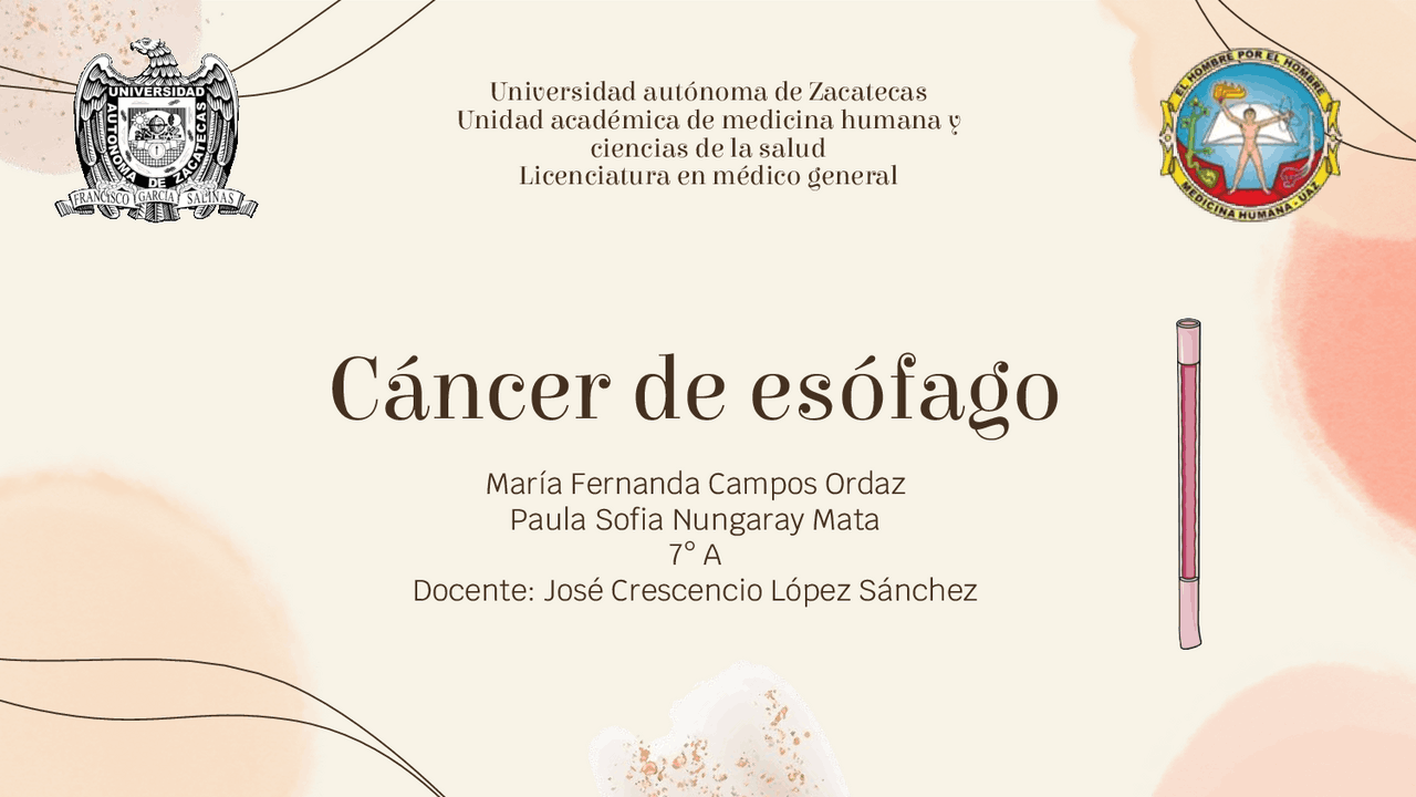 Exposición de cáncer de ésofago | Diapositivas de Oncología | Docsity
