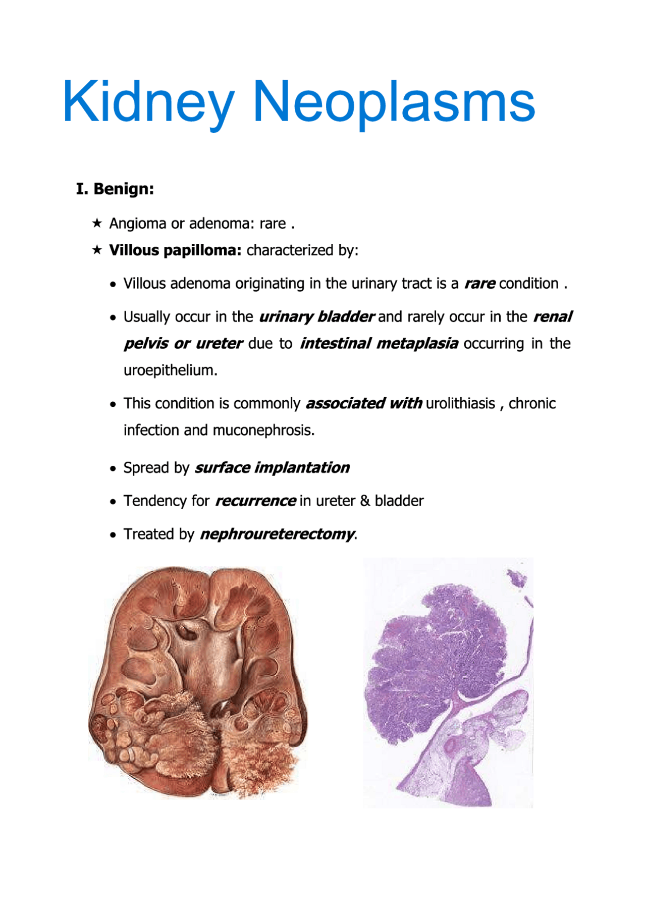 Kidney Neoplasms Notes | Study Guides, Projects, Research Medical ...