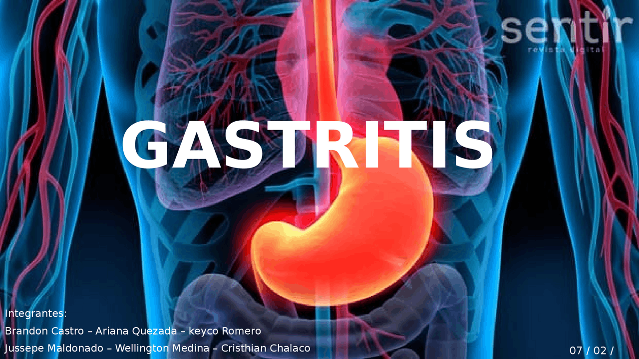 Gastritis y su clasificación | Diapositivas de Fisiopatología | Docsity