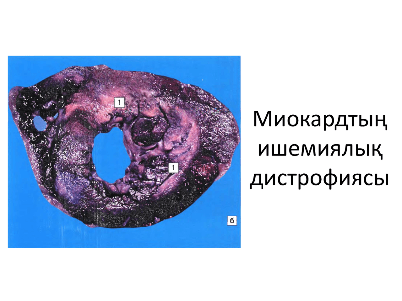 Патологическая физиология Конспекты лекций Патологическая физиология