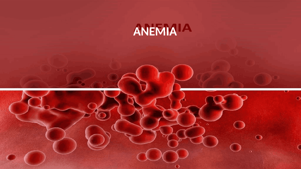 ANEMIA CLASIFICACION | Esquemas y mapas conceptuales de Fisiología ...