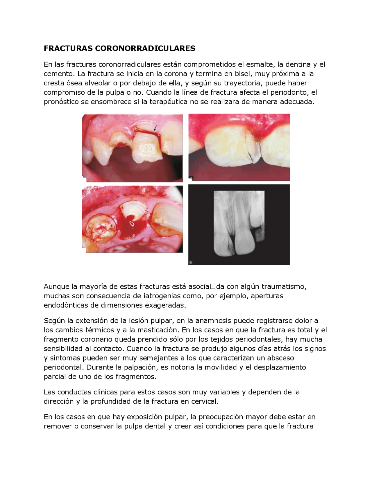 Endodoncia