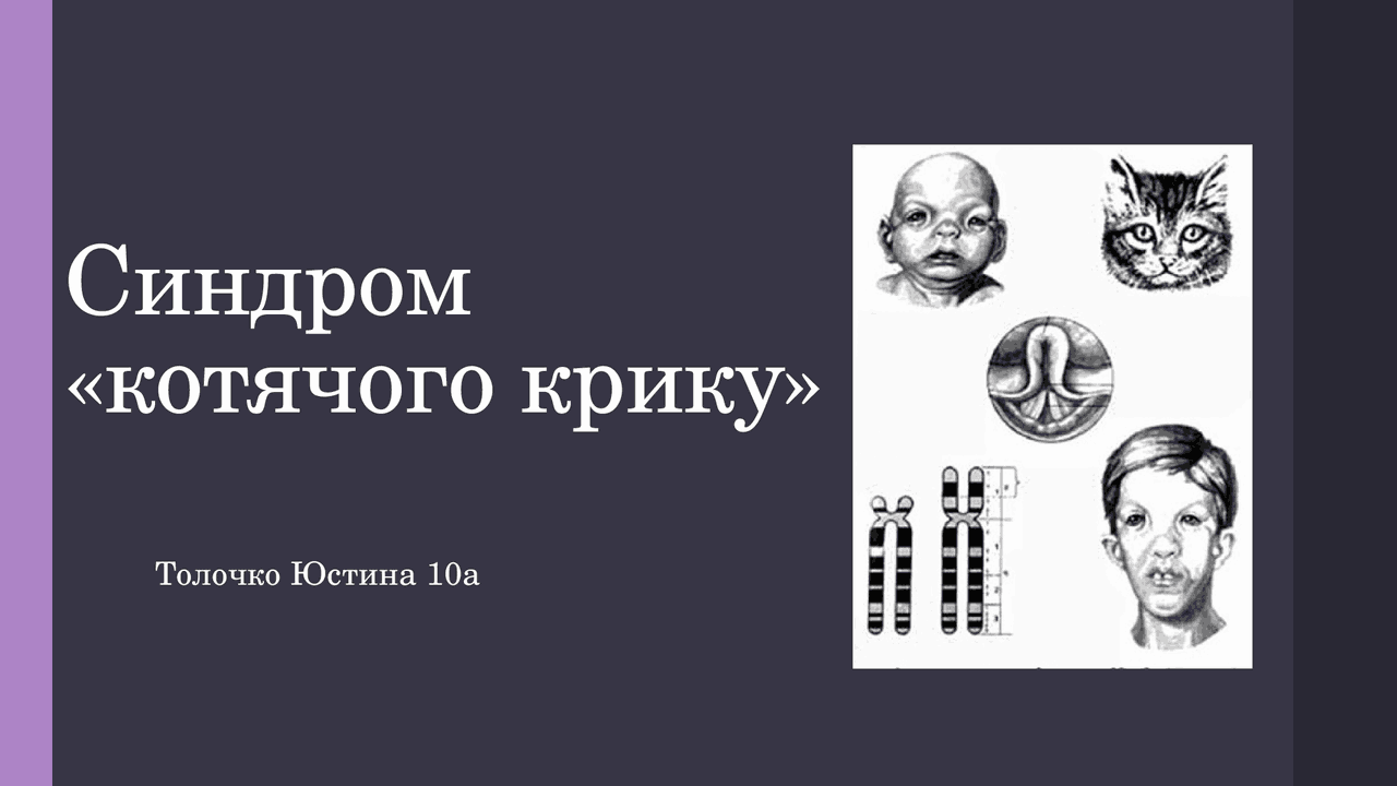 Презентація на тему синдром котячого крику Презентации Медицинская