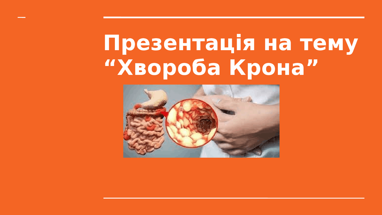 Презентація на тема хвороба Крона Презентации Медицина Docsity