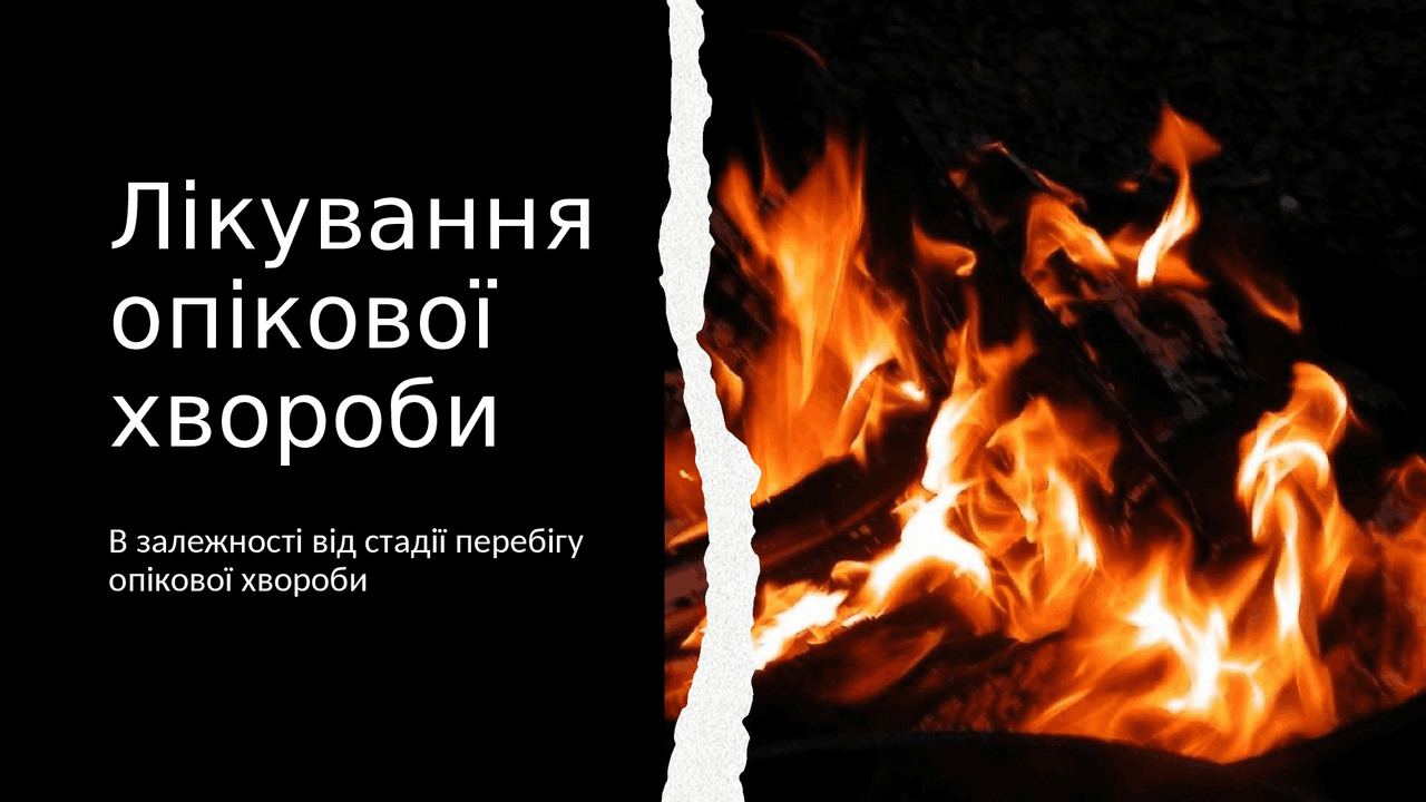 Презентація опікова хвороба Рефераты Общая хирургия Docsity