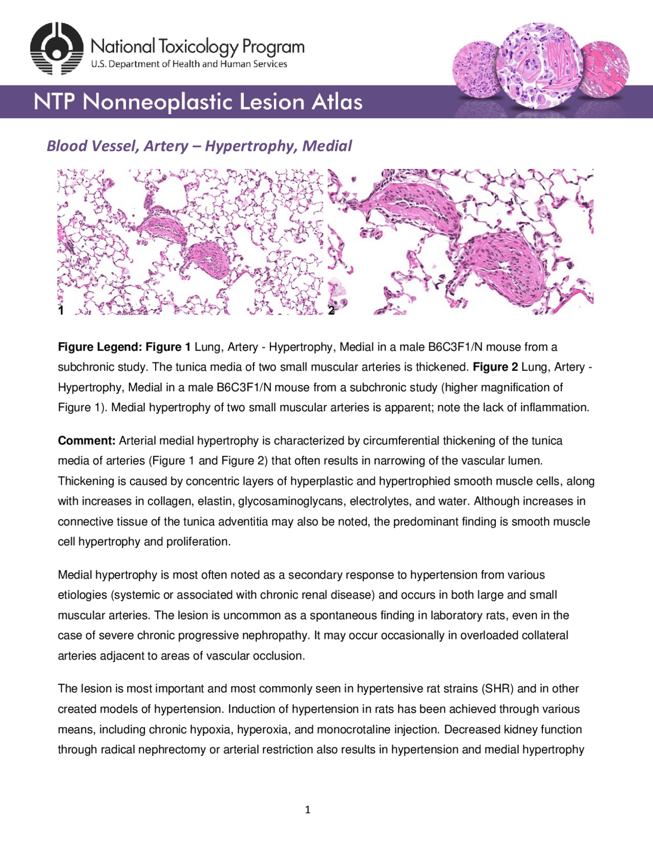 Blood vessel, Artery | Study notes Medical Sciences | Docsity