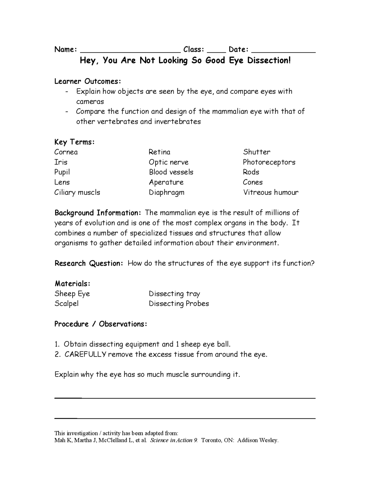 Hey, You Are Not Looking So Good Eye Dissection! | Lecture notes Design ...