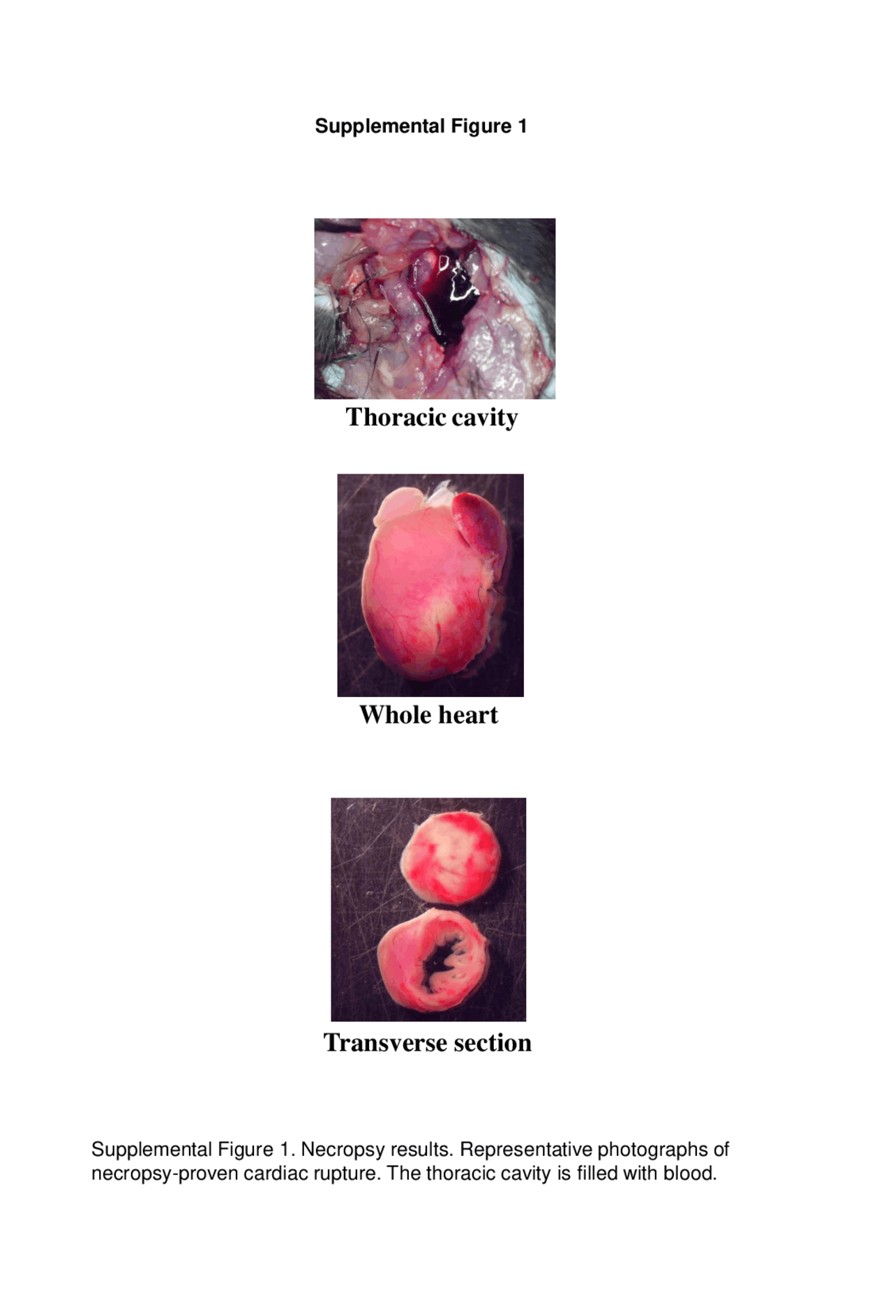 Thoracic cavity Whole heart Transverse section | Slides Histology | Docsity