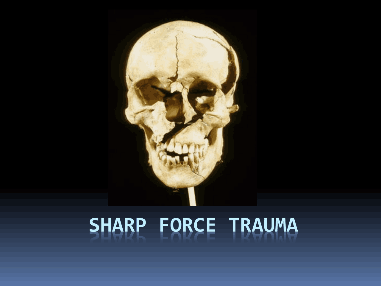 Sharp Force Trauma | Summaries Biology | Docsity