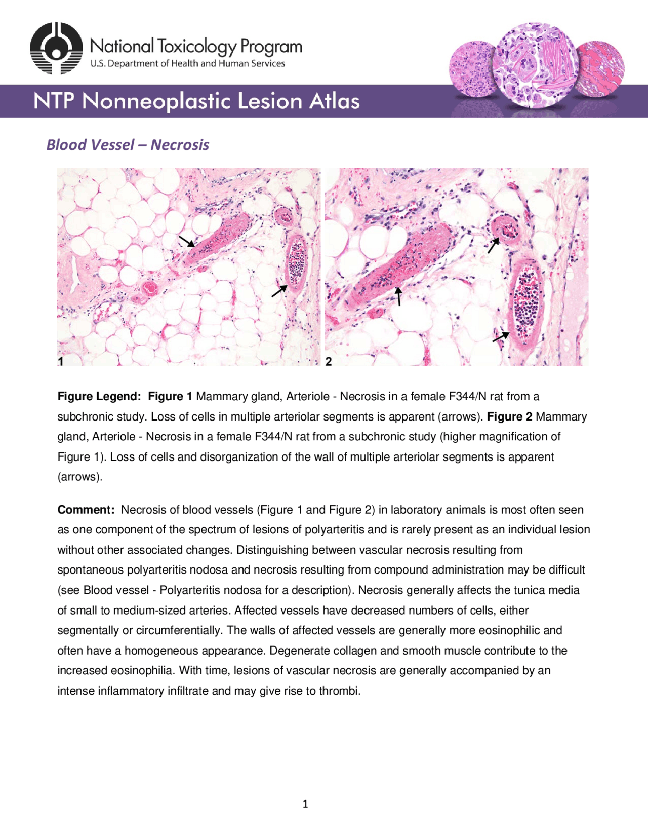 Blood vessel - Necrosis | Study notes Toxicology | Docsity