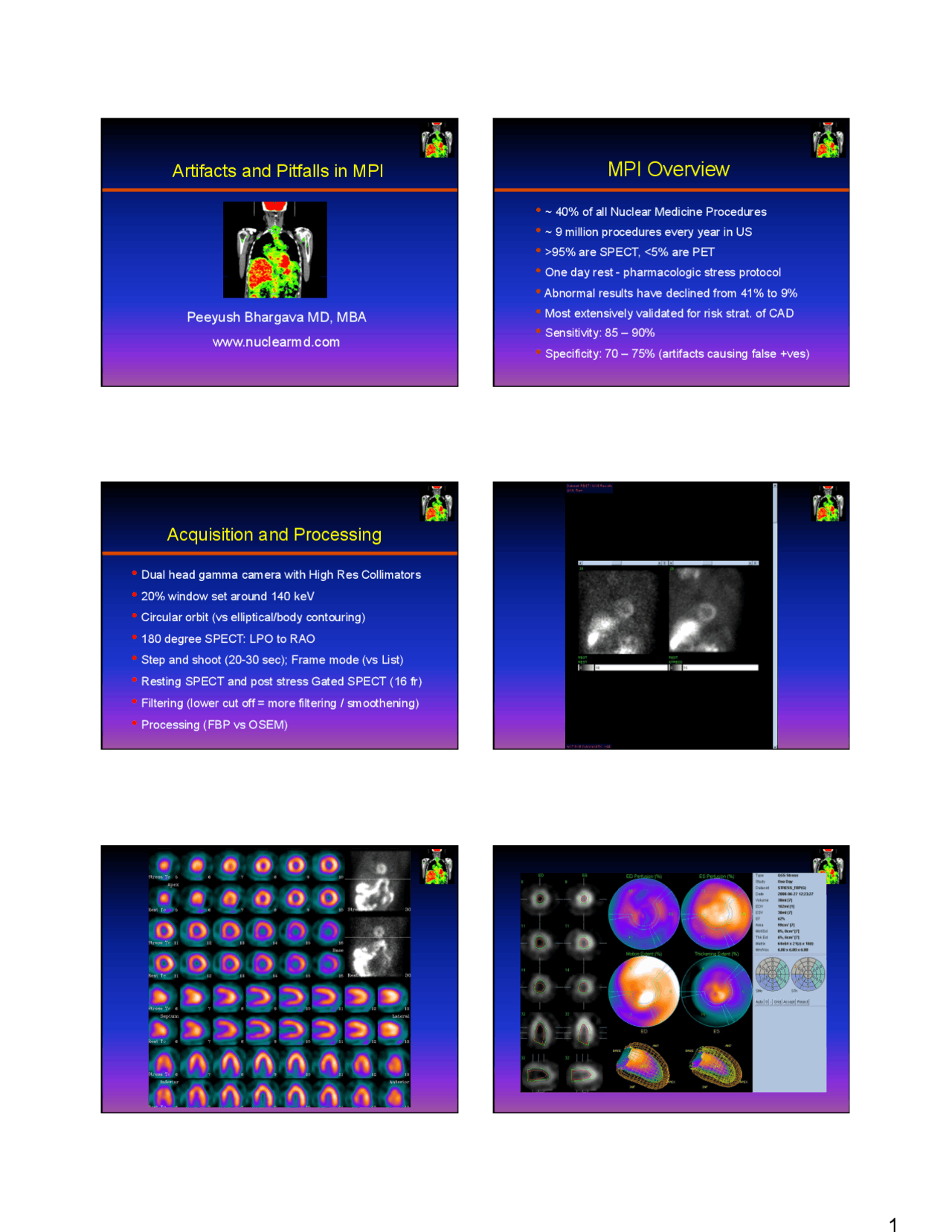 MPI Artifacts | Lecture notes Nuclear medicine | Docsity