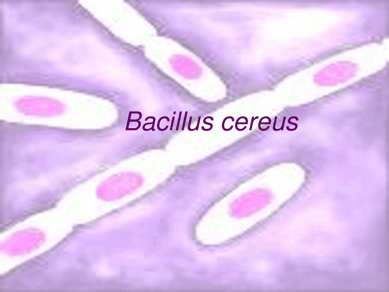 Bacillus cereus - Microbiologia dos Alimentos | Slides Microbiologia ...