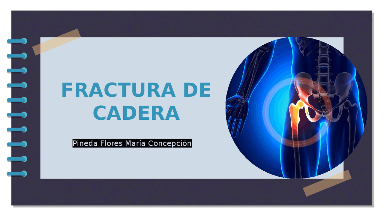 Fractura de cadera, relacionado con el área de traumatología y ...